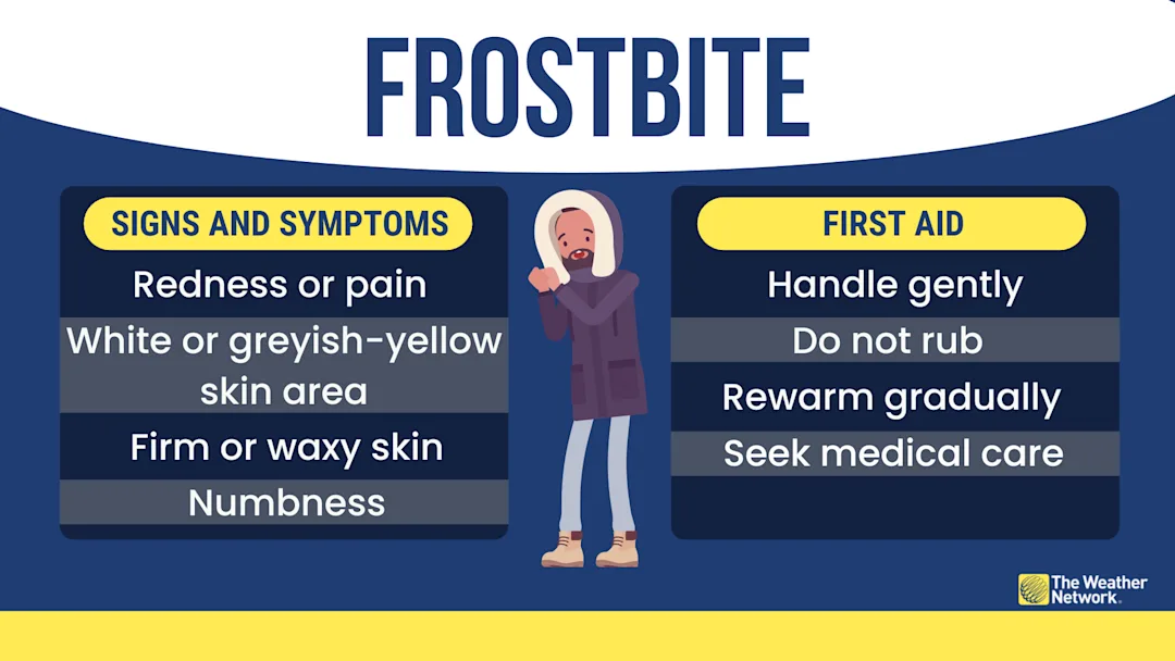 What is frostbite, what are the signs and how should we treat it? - The ...
