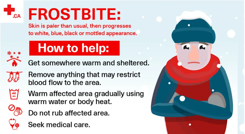 Understanding the warning signs of frostbite - The Weather Network