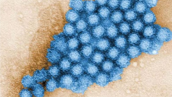 'Winter vomiting disease' on the rise in Canada - The Weather Network