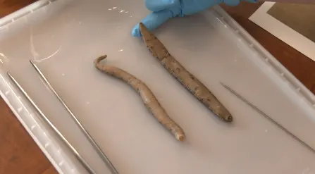 Cooling off in the lake? Here's how to handle leeches - The Weather Network