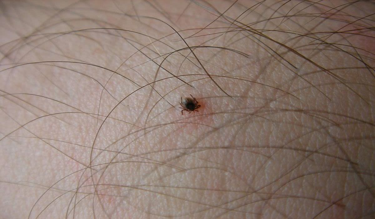 Quoi faire quand une tique nous infecte - MétéoMédia