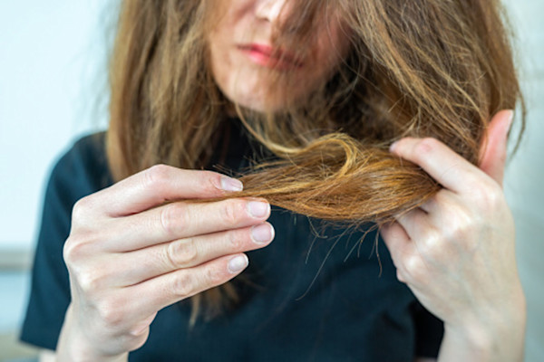 Make these simple routine changes to prevent dry, brittle hair in ...
